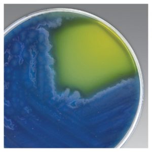 Wilkins Chalgren Anaerobe Agar 500g - LabMal